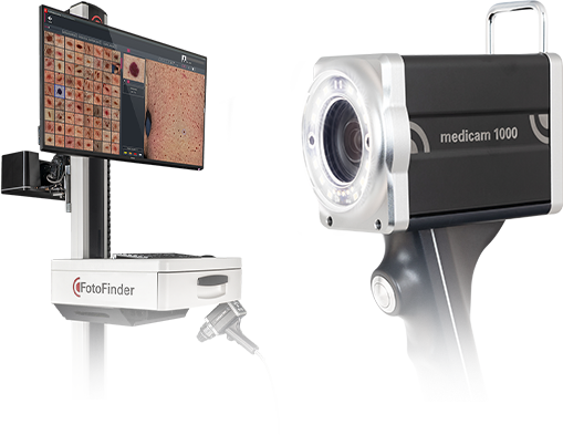 Mole mapping - DERMATOLOGY CIRCLE