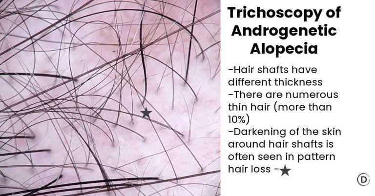 What is Trichoscopy and Who Are Trichologists? - Dermatology Circle NYC